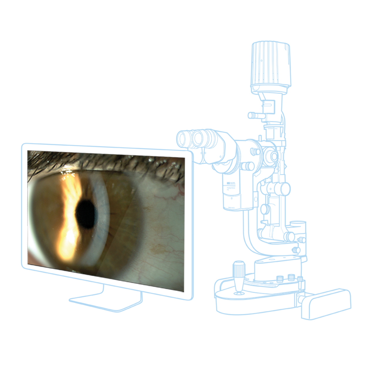 Slit lamp imaging